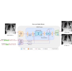 PRISM: An Explainable Generative AI Model for Medical Imaging | WebWire
